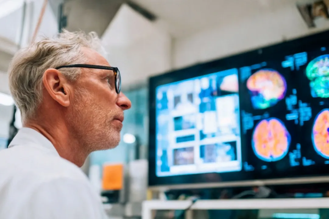 Raziskava: Umetna sladila pospešujejo staranje možganov | Info360